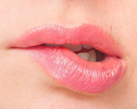 How To Treat Sunburned Lips - Treatment Options And Home Remedies 2022 ...