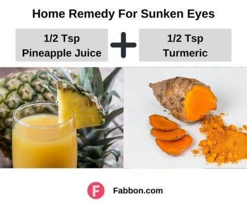 15 Home Remedies For Sunken Eyes | Fabbon