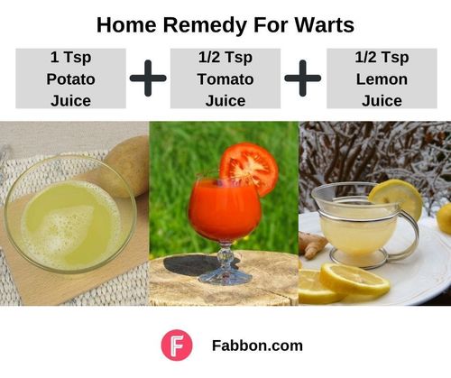 How To Remove Warts: 15 Most Effective Home Remedies | Fabbon
