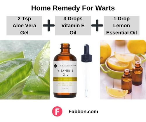 How To Remove Warts: 15 Most Effective Home Remedies | Fabbon