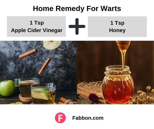 How To Remove Warts: 15 Most Effective Home Remedies | Fabbon