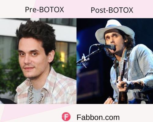 25 Celebrities Who Use Botox - 2022 (With Images) | Fabbon