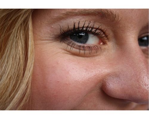 How To Get Rid Of Wrinkles? All 7 Treatment Options | Fabbon